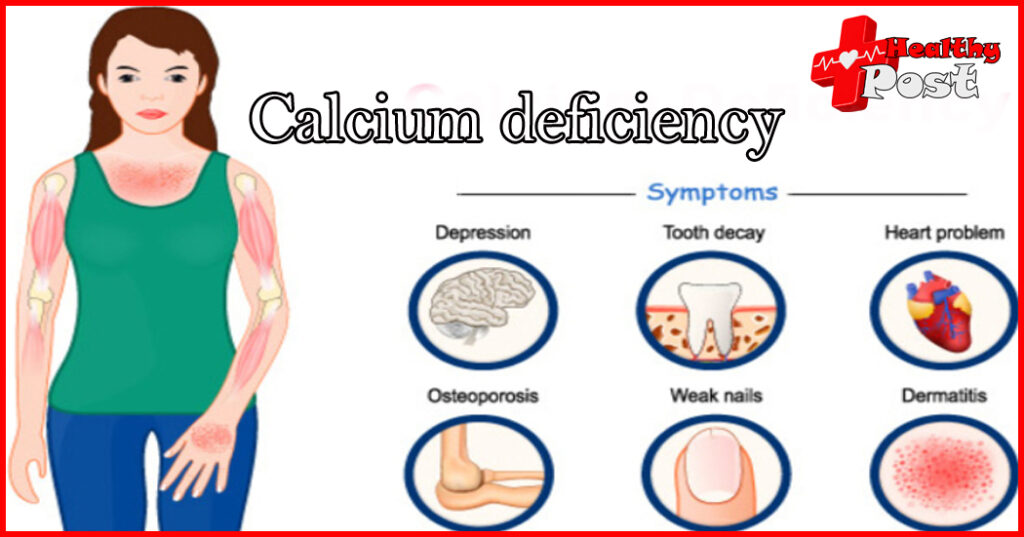 How do you know you are calcium deficient and how to supplement calcium ...